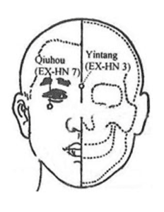 Acupressure points for the face and head - Hampson Training